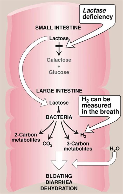 Lactase Enzyme Function Source Lactase Deficiency And Treatment