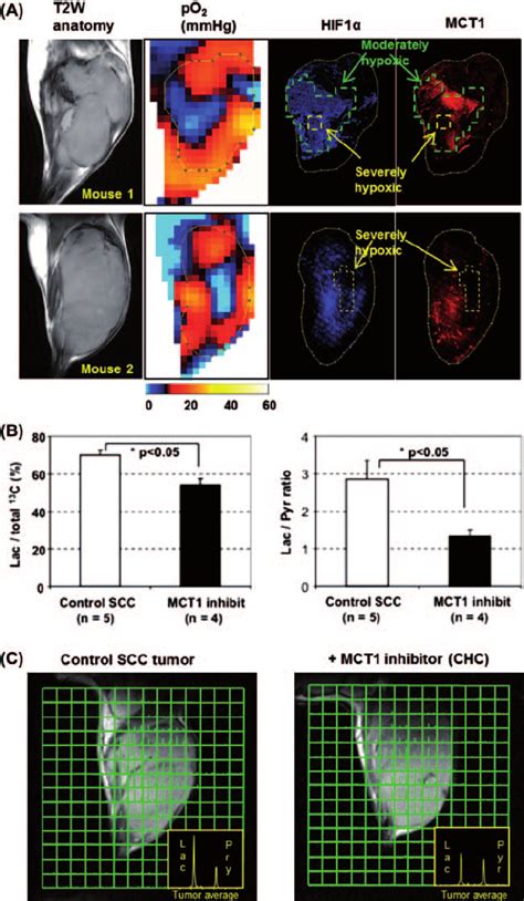 Monocarboxylate Transporter 1 Mct1 Dependent Uptake Of [1 13 Download Scientific Diagram