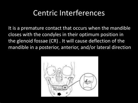 Types Of Occlusal Interference At Lee Porter Blog