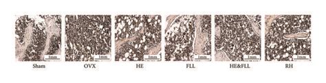 Effects Of He And Fll On Tracpalp In Ovx Rats Serum Tracp A And Balp