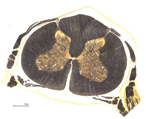 Diagram Of Weigert Pal Stain Quizlet