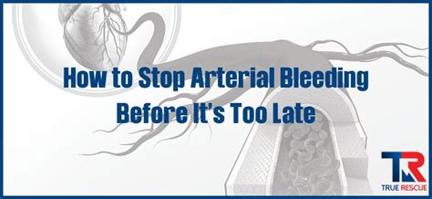 Arterial Bleeding