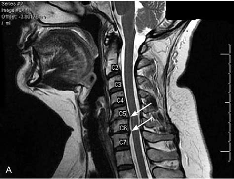 Ajay Kannan On Linkedin A 39 Year Old Patient Mr X Presenting To