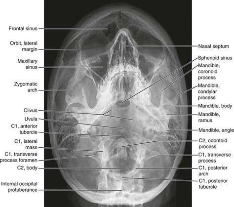 Clivus On X Ray