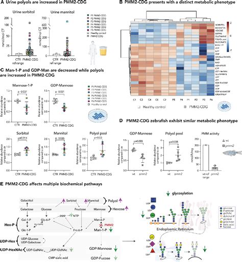 Figure 1 From Tracer Metabolomics Reveals The Role Of Aldose Reductase In Glycosylation