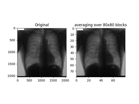 Github Harishanand Jsrt Parser This Is A Data Parser To Obtain Images And Descriptions From