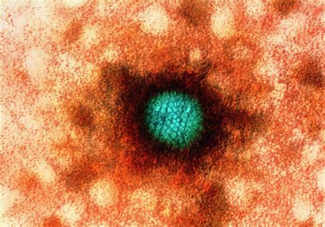 Herpes Simplex Virus Photograph By Dr Kari Lounatmaascience Photo