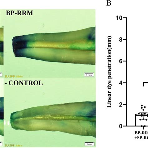 Micro Ct Evaluation A 3d Reconstruction Of Root Canal With Isthmus B Download Scientific
