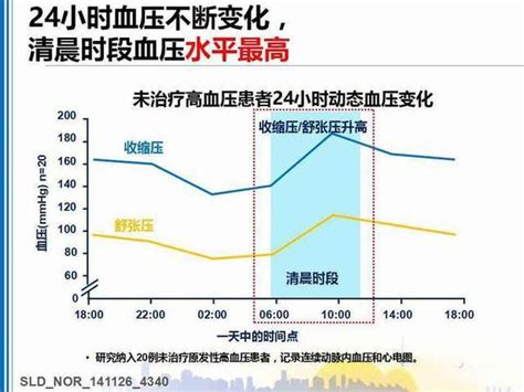 血压忽高忽低，到底什么原因，医生说：6个原因！ 知乎