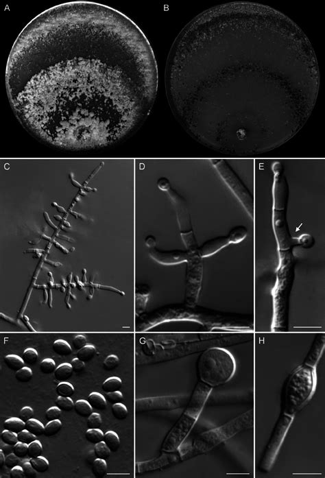 Trichoderma Bissettii Sp Nov Uthsc 08 2443 A And B Colonies On