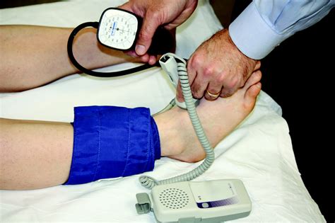 Ankle Brachial Index Virginia Heart