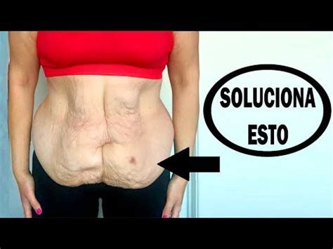 Vientre Inferior CaÍdo Y Colgante Aplanar El Abdomen Bajo Abultado Y