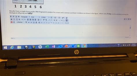 Solved 1 2 3 4 5 6 Results From A Single Locus Probe Dna