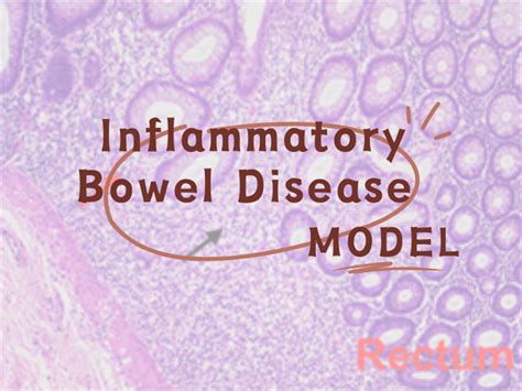 Inflammatory Bowel Disease Ibd Nhp Model China Inflammatory Bowel Disease Ibd Nhp Model