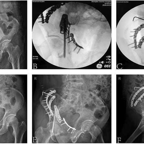 Three Dimensional Printed Model A And B Three Dimensional Printed Download Scientific