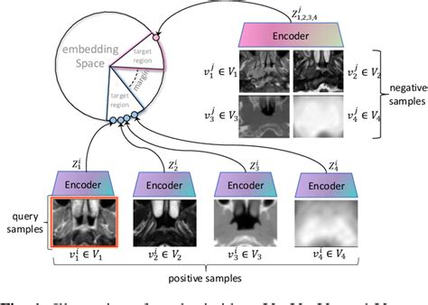 Figure 1 From Multi View Contrastive Learning With Additive Margin For Adaptive Nasopharyngeal