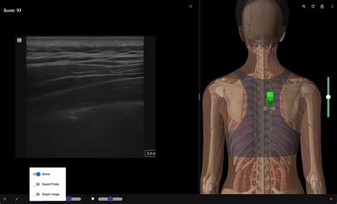 Erector Spinae Plane Esp Block