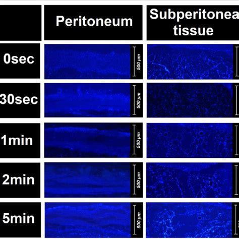 Tissue Disruption Following Hius At Different Durations Left Side