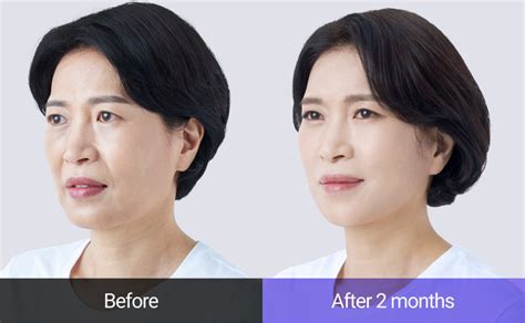 리팅성형외과