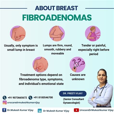 Understanding Breast Fibroadenomas A Comprehensive Guide Healcare