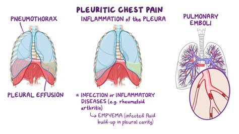 Lungs Diagram Pleura