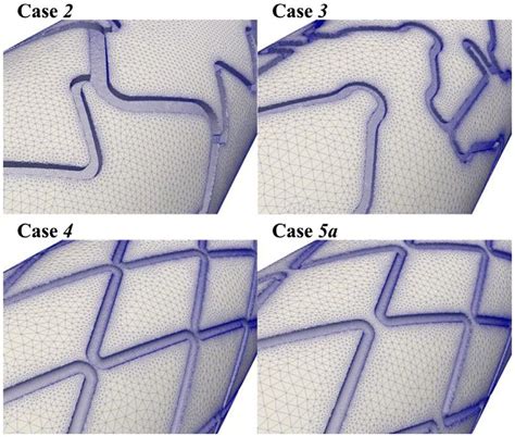 Computational Fluid Dynamics Meshes With Tetrahedral Elements Of Download Scientific Diagram