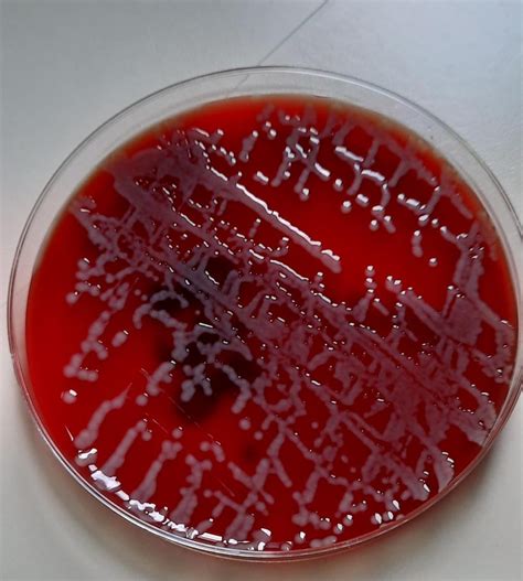 Escherichia Coli E Coli Is A Gram Negative Rod Shaped Facultative