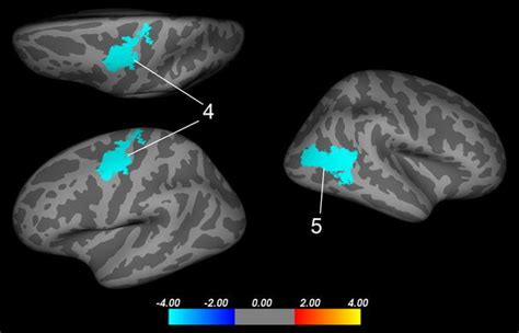 Clusters Of A Significant Interaction Between Maltreatment Exposure And Download Scientific