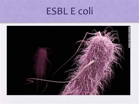 Ppt Multidrug Resistant Bacteria Powerpoint Presentation Id 1899976