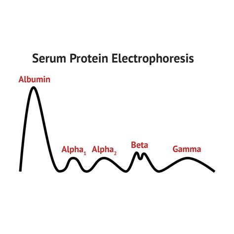 Serum Protein Electrophoresis Serum Medical Laboratory Clinical Chemistry