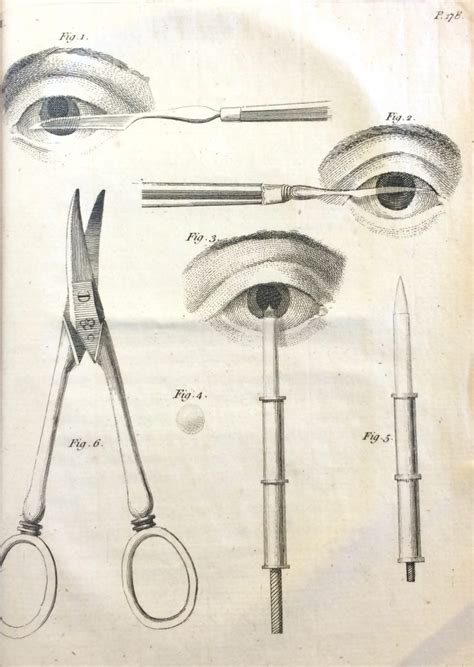 The Eye As Art Anatomy And Vision In The 18th Century Dittrick
