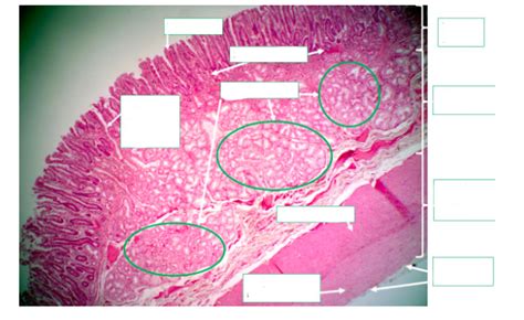 Duodenum Slide 40 X Magnification From Lab Manual Diagram Quizlet