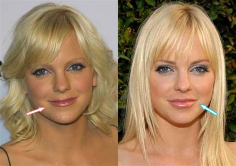 Anna Faris Plastic Surgery Revealed Before And After 2021