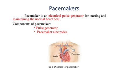 Solution Pacemakers Types Of Pacemakers Ventricular Asychronous