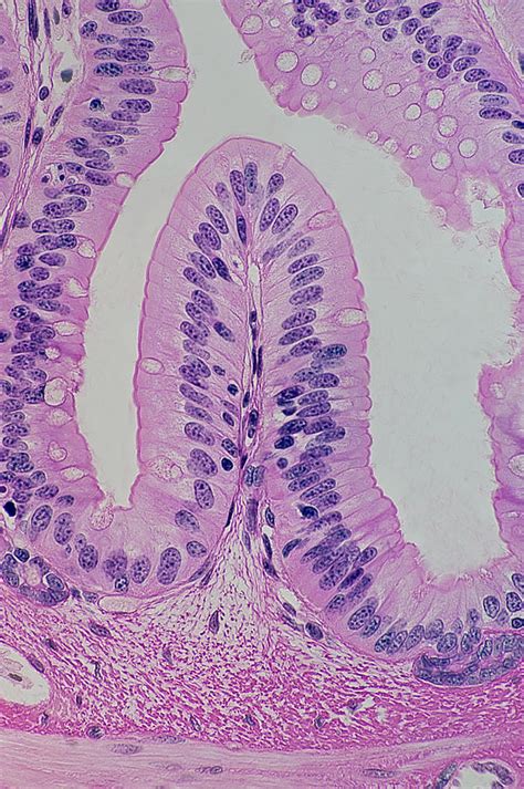 Simple Columnar Epithelium A Labeled Diagram And