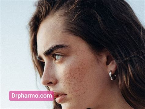 کک و مک چیست؟ بررسی انواع کک و مک و راه های درمان آن