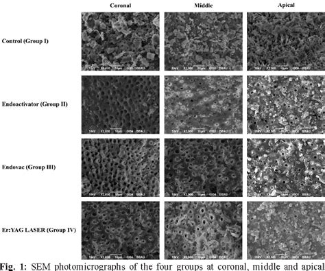 Table 1 From A Comparative Evaluation Of Smear Layer Removal Using