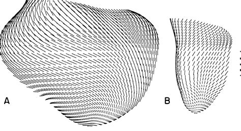 Detailed Descriptions Of Left And Right Ventricular Ge