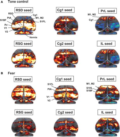 Functional Connectivity Of The Cortical Midline Structures Cms With Download Scientific