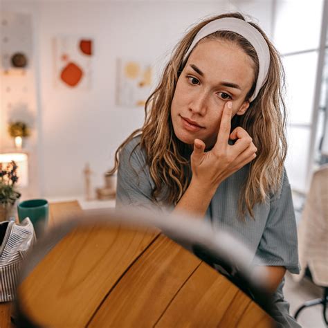 Preventing Dark Circles Around Eyes Forefront Dermatology