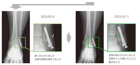 画像7｜プロダクトデザイン、医療機器デザインのペック株式会社