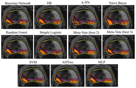 Segmentation Results Using Different Machine Learning Algorithms Download Scientific Diagram