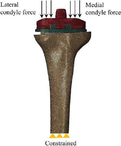 Loading And Boundary Conditions Of Finite Element Model Download