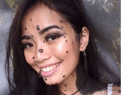 Malaysian Woman Body Covered In Moles Is Going To Next Miss Universe कभ रकषस कहकर