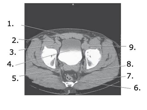 322 Exam 3 Image 12 Diagram Quizlet