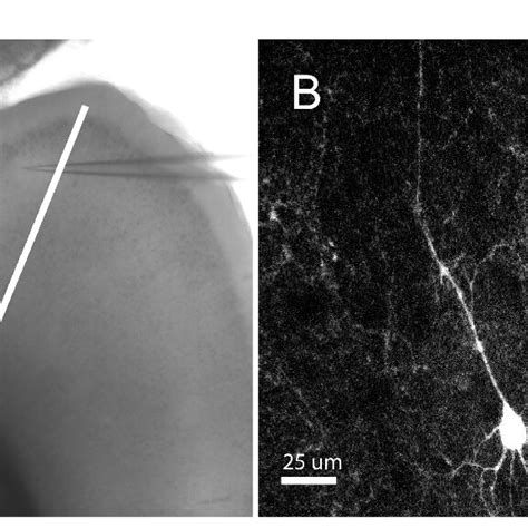 Orbitofrontal Cortex Location And Rs Cell Example A Mouse Brain