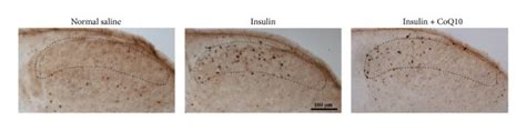 Immunohistology Of C Fos On Lumber Spinal Cord And Rt Pcr Of C Fos