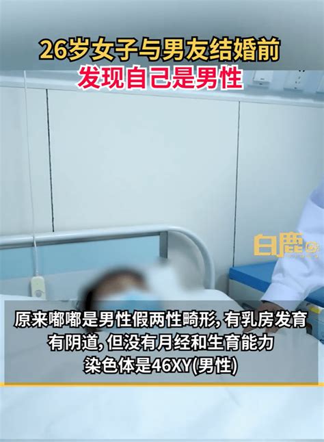 26岁女子婚前发现自己竟是“男性”， 无月经和生育能力，确诊为雄激素不敏感综合征性别女士女性