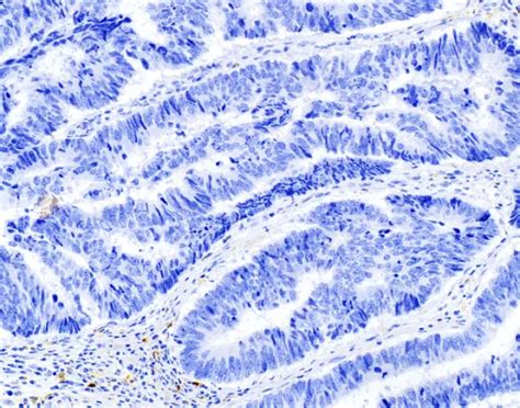 Laboratory High Speed Digital Instrument Digital Pathology Slide Scanner With 6 Slides China