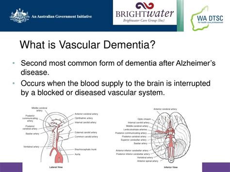 Vascular Dementia Types At Jason Criner Blog Vascular Dementia Types At Jason Criner Blog